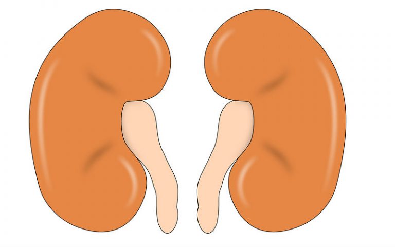 ¿Qué es un cólico nefrítico? Conoce sus causas y cuanto dura - CuídateCV