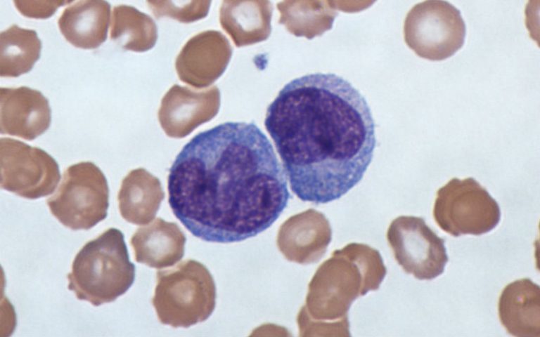 MONOCITOS: Qué son y cuáles son sus valores normales - cuídateCV