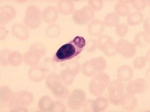 Monocitos altos en sangre: ¿Qué significa? - cuídateCV