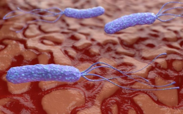 Helicobacter pylori : qué es, cómo se transmite y síntomas - CuídateCV
