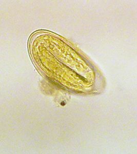 Oxiuros: infección intestinal por parásitos - CuídateCV