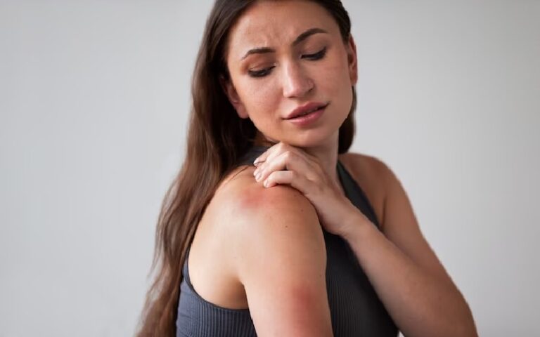 Erupción cutánea: tipos comunes, causas y tratamiento - CuídateCV